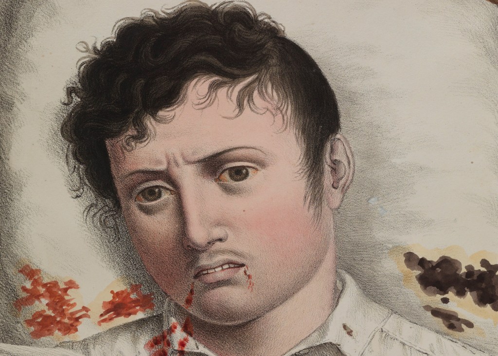 Yellow Fever – Yellow Fever Martyrs Museum